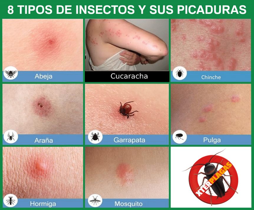 Insectos que causan picaduras y sus efectos - Ecoarmonia